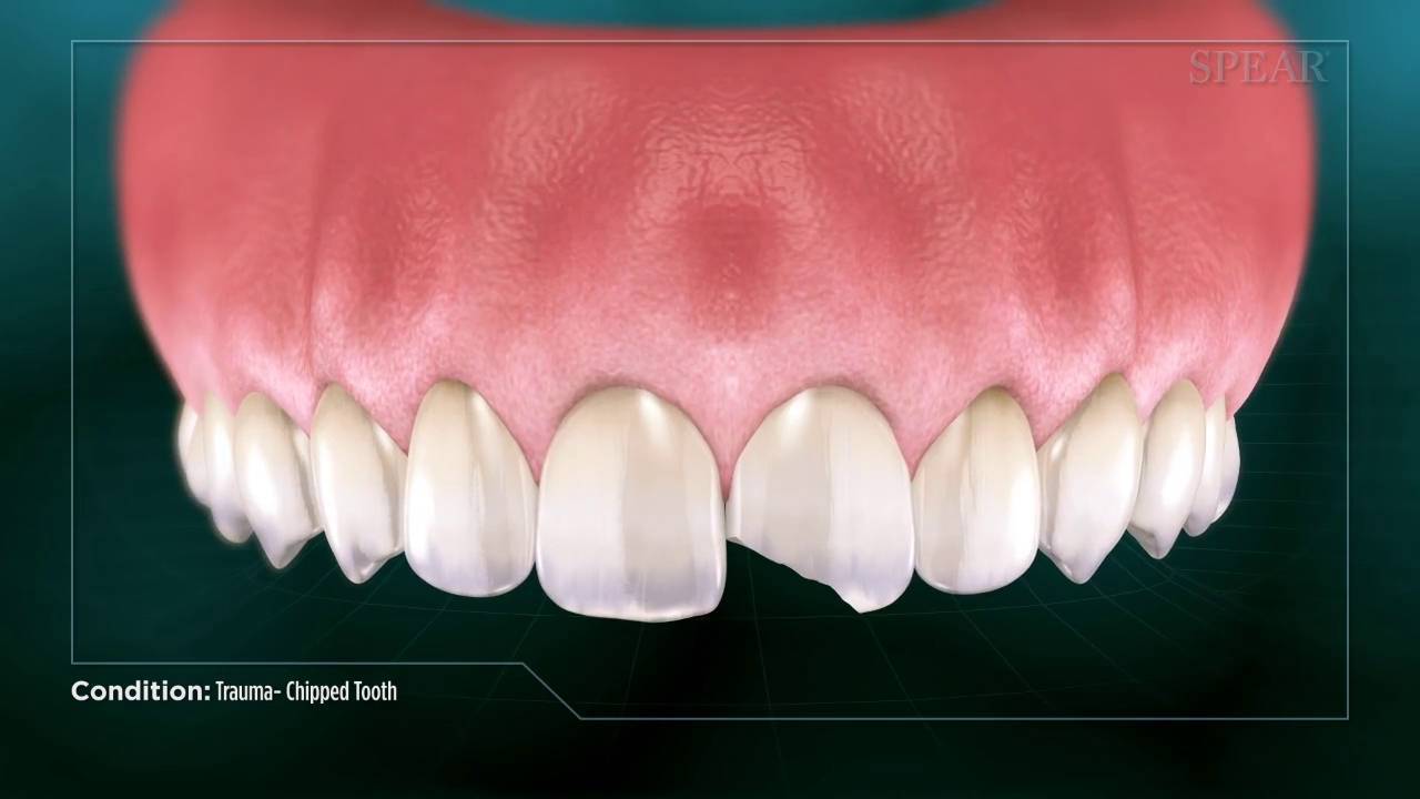 Your Concerns – ADHPL